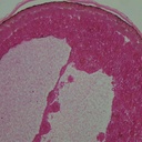 Preparación microscópica de mórula | Zeigen